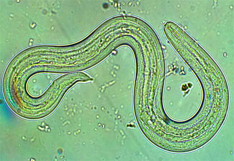 Potentially Deadly Parasite Found in 5 Florida Counties